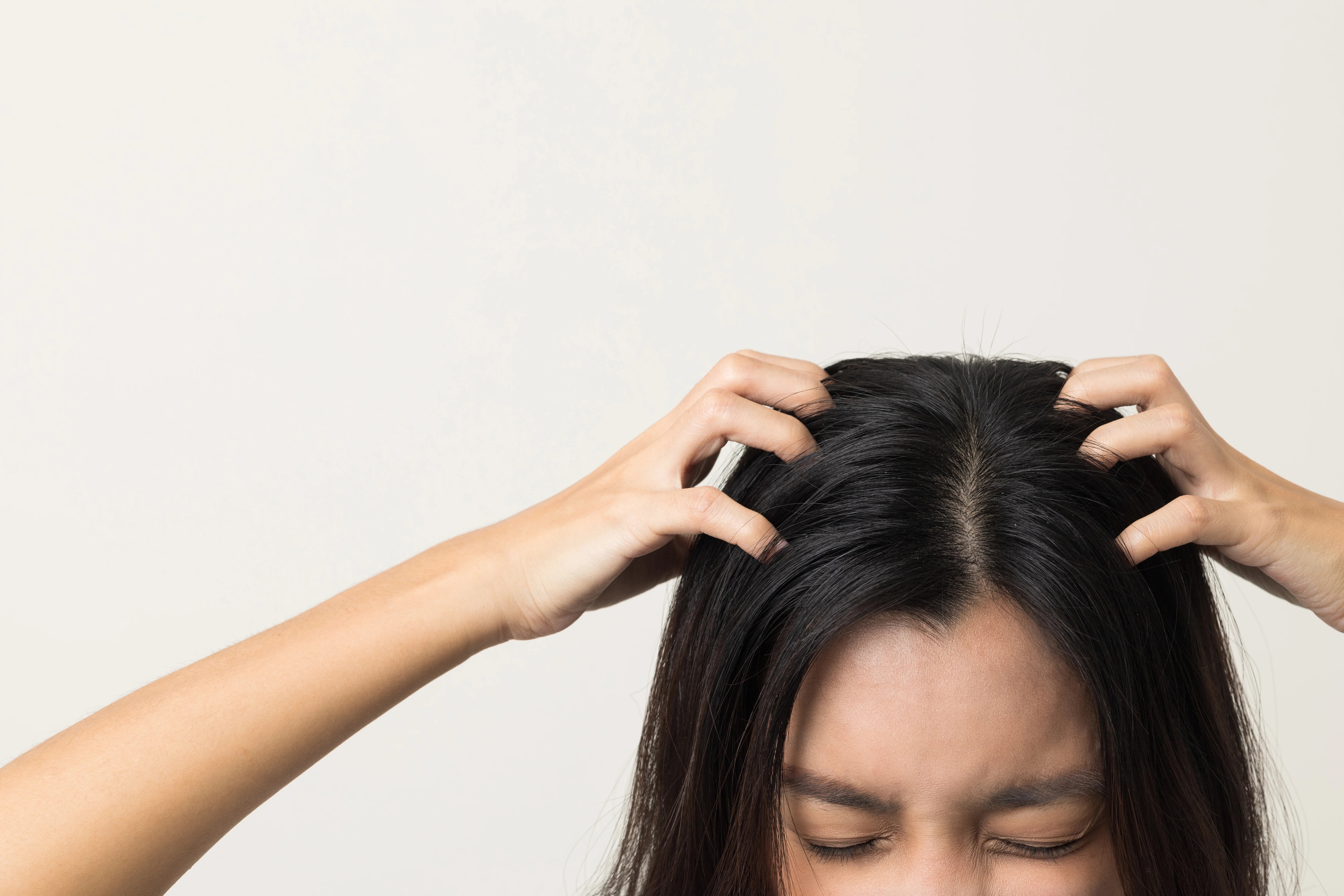 Itchy scalp – Concept Cosmetics